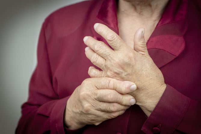 First classification criteria for hand OA phenotypes