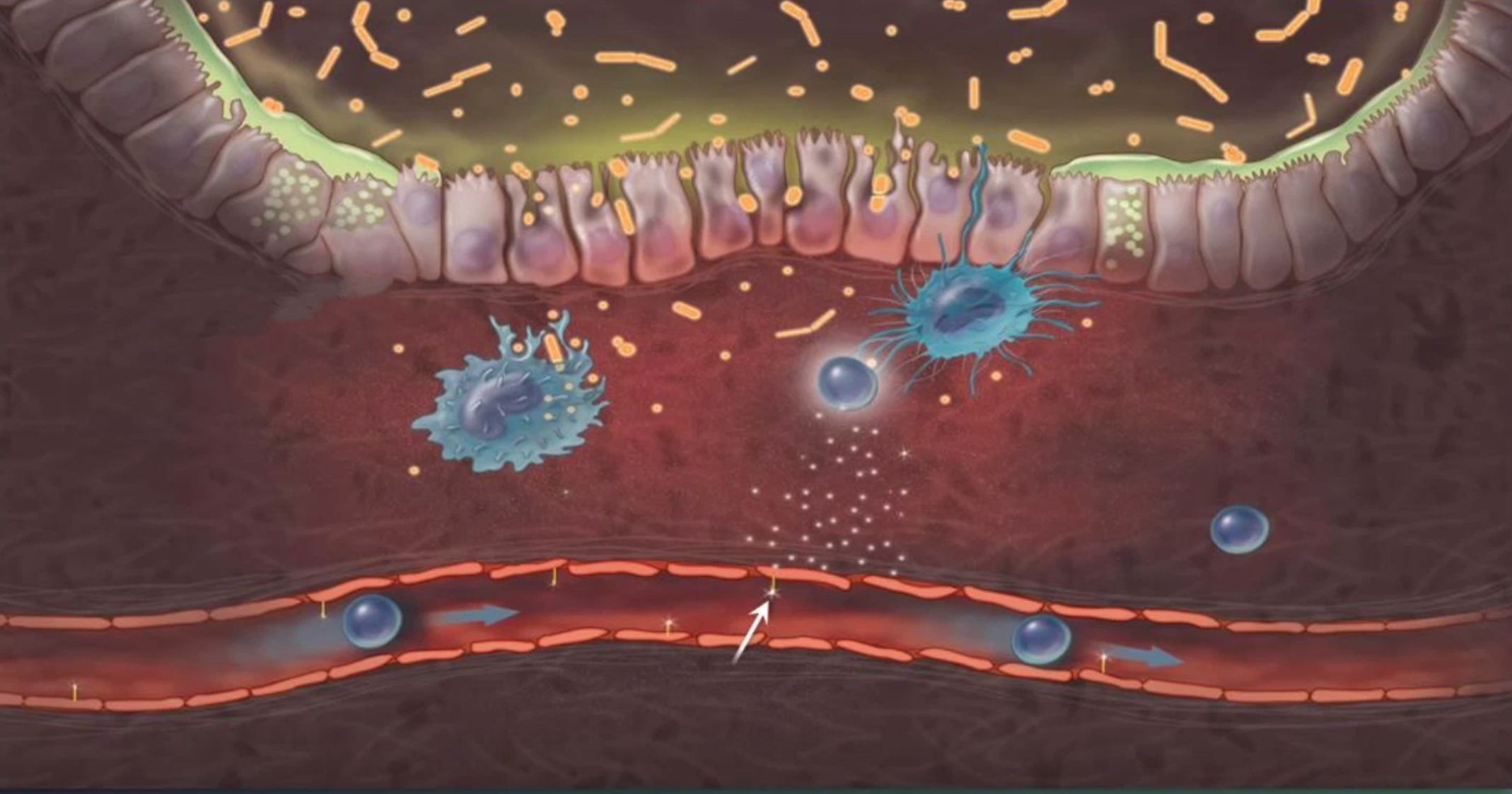 Top down or step up? IBD treatment approach still not clear-cut