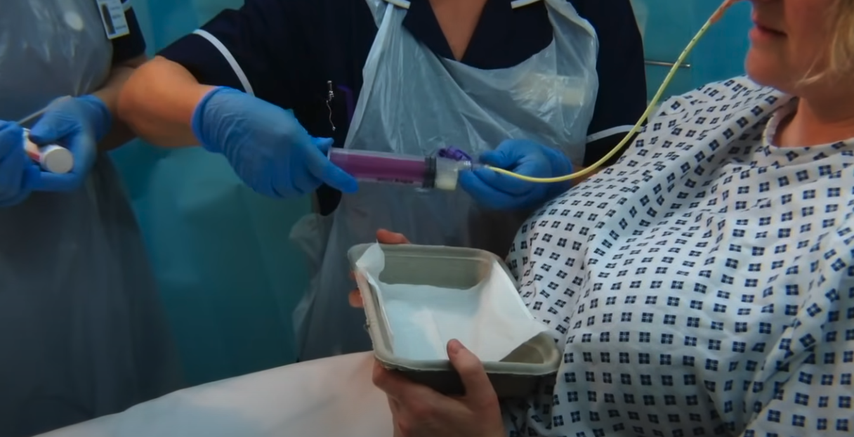 Findings support EEN as initial induction therapy for Crohn’s disease